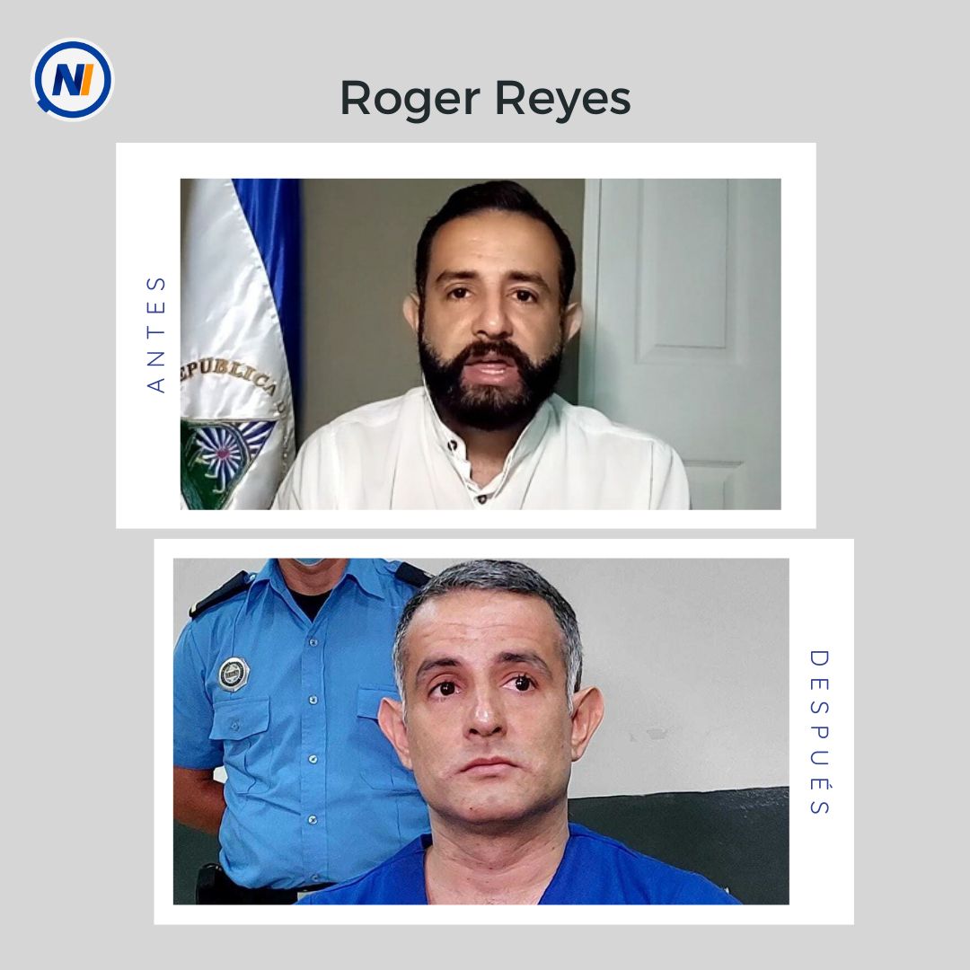 Este es el extremo deterioro de los presos políticos exhibidos por el ...